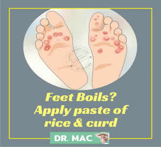 Feet Boils? Apply paste of rice & curd - Dr Chaudhary's Ayurveda